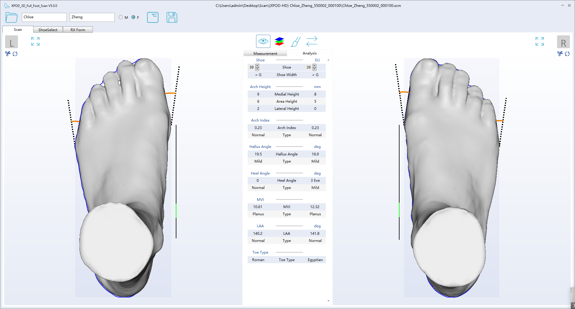 ScanPod3D 3D Laser Foot Scanner | Orthotic Insole CAD & CAM ...