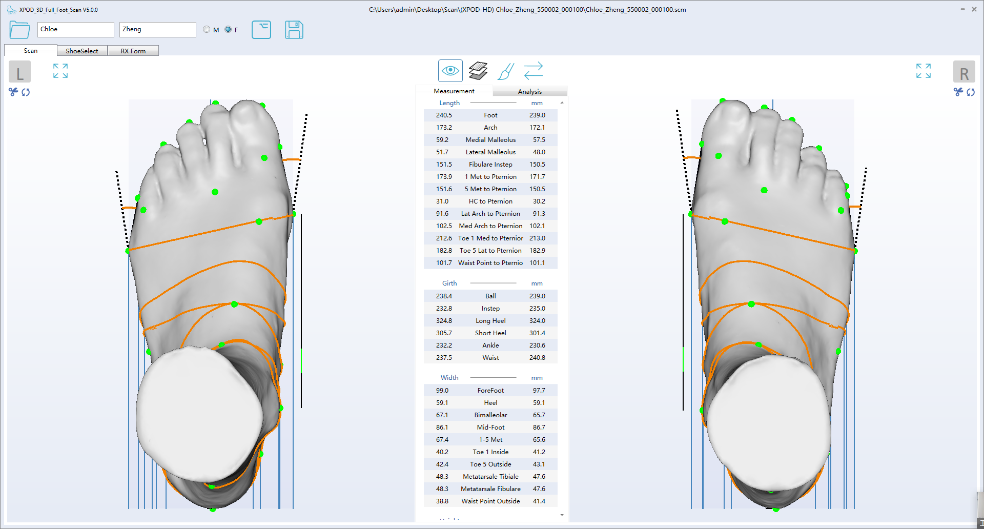 ScanPod3D 3D Laser Foot Scanner | Orthotic Insole CAD & CAM ...