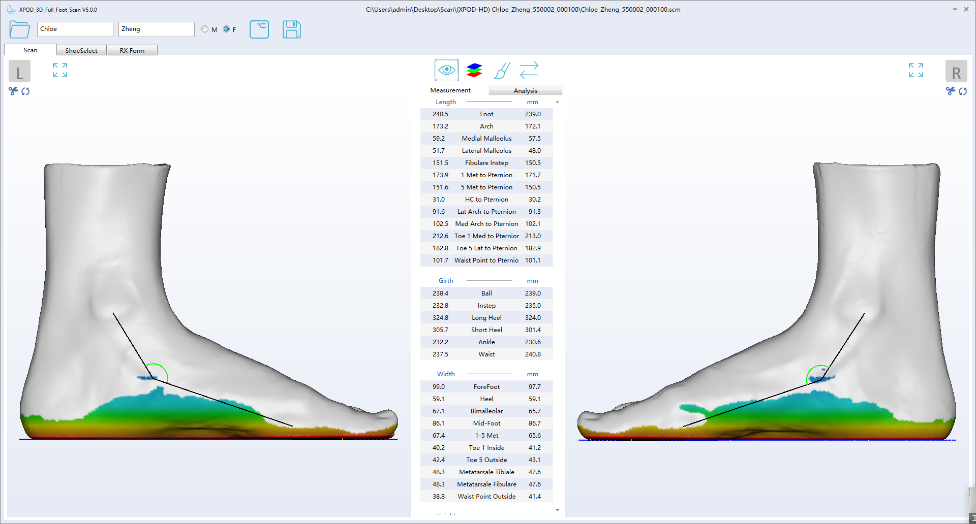 ScanPod3D 3D Laser Foot Scanner | Orthotic Insole CAD & CAM ...