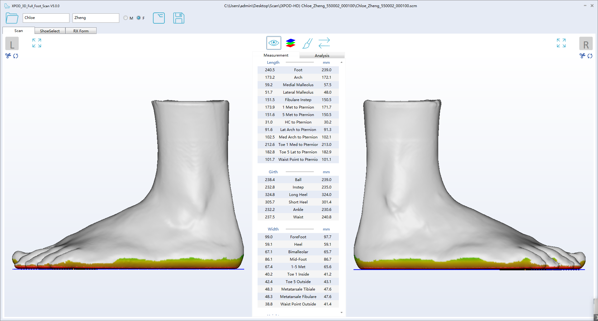 ScanPod3D 3D Laser Foot Scanner | Orthotic Insole CAD & CAM ...