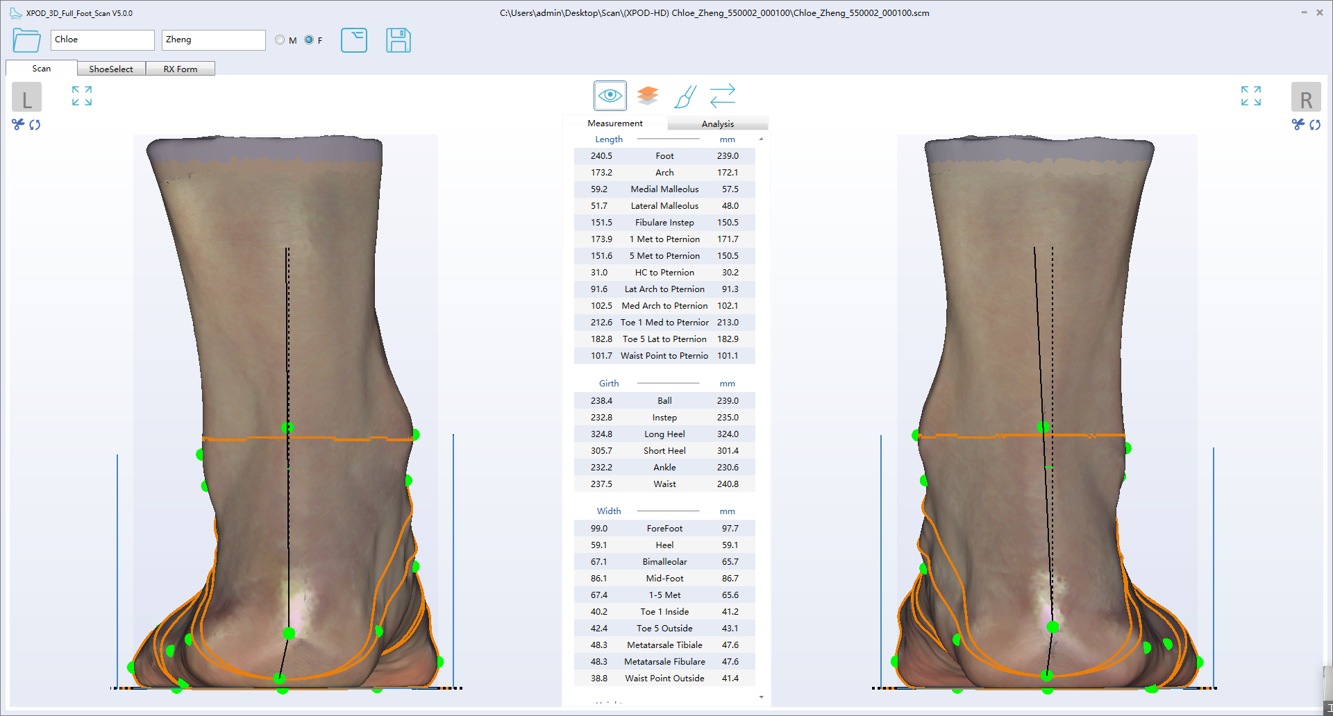 ScanPod3D 3D Laser Foot Scanner | Orthotic Insole CAD & CAM ...