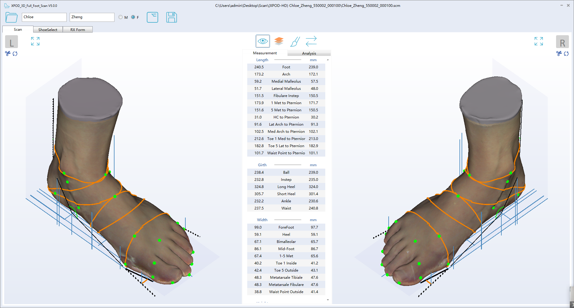ScanPod3D 3D Laser Foot Scanner | Orthotic Insole CAD & CAM ...