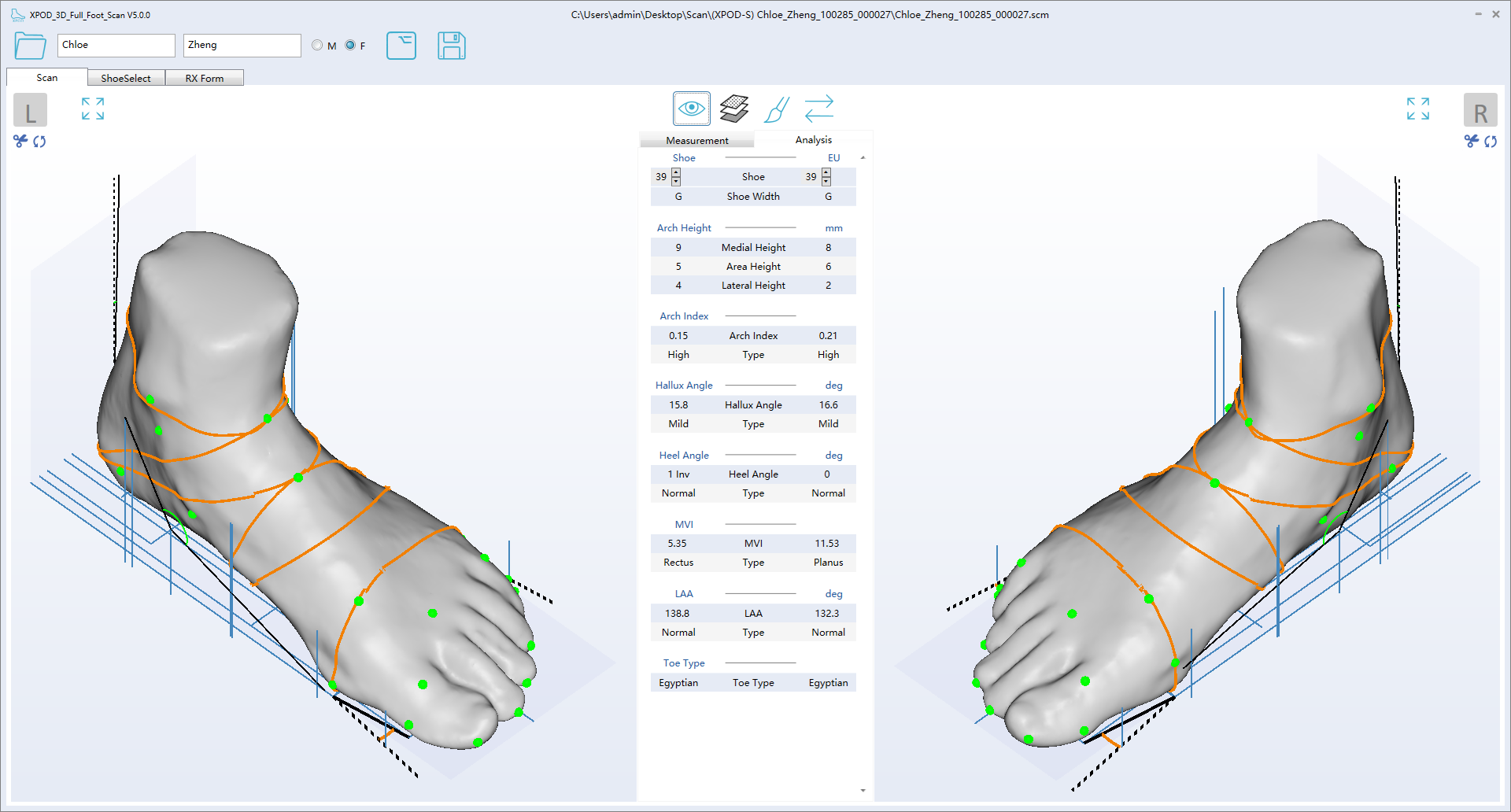 ScanPod3D 3D Laser Foot Scanner | Orthotic Insole CAD & CAM ...