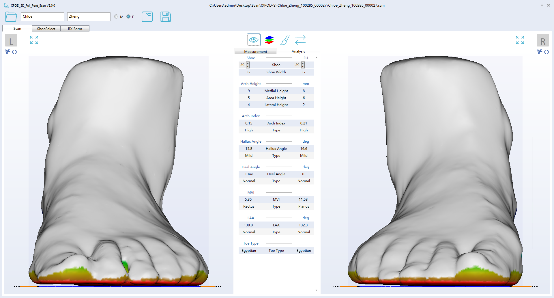 ScanPod3D 3D Laser Foot Scanner | Orthotic Insole CAD & CAM ...
