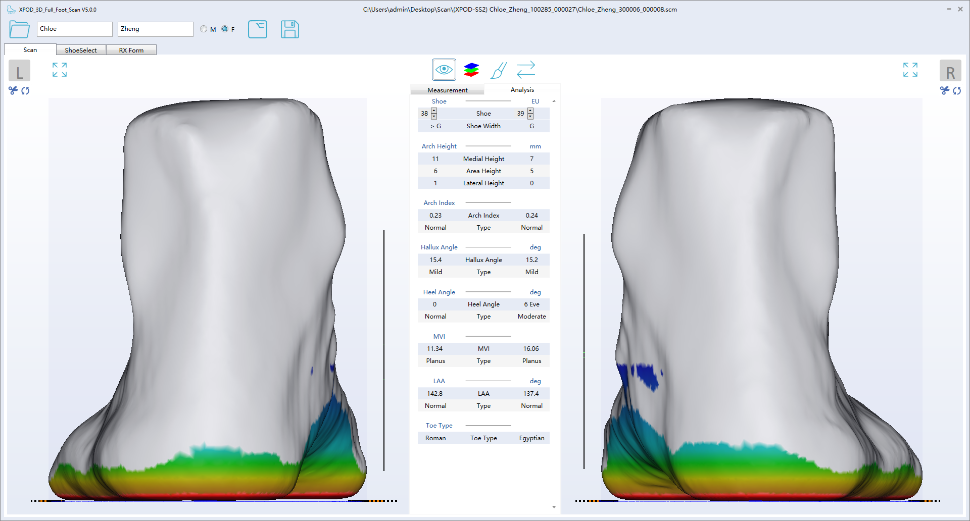 ScanPod3D 3D Laser Foot Scanner | Orthotic Insole CAD & CAM ...
