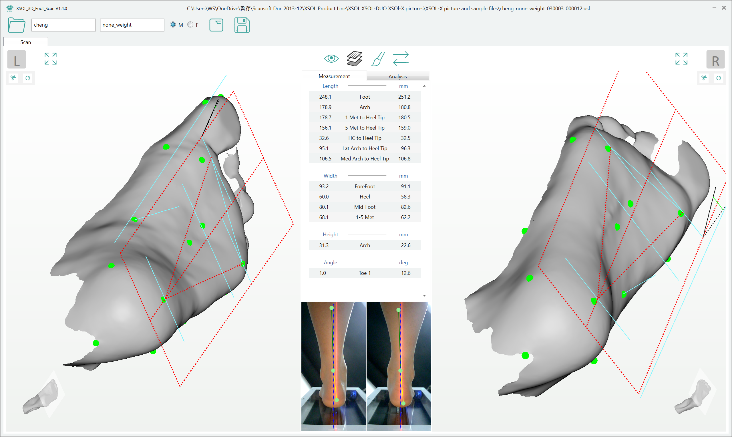 ScanPod3D 3D Laser Foot Scanner | Orthotic Insole CAD & CAM ...