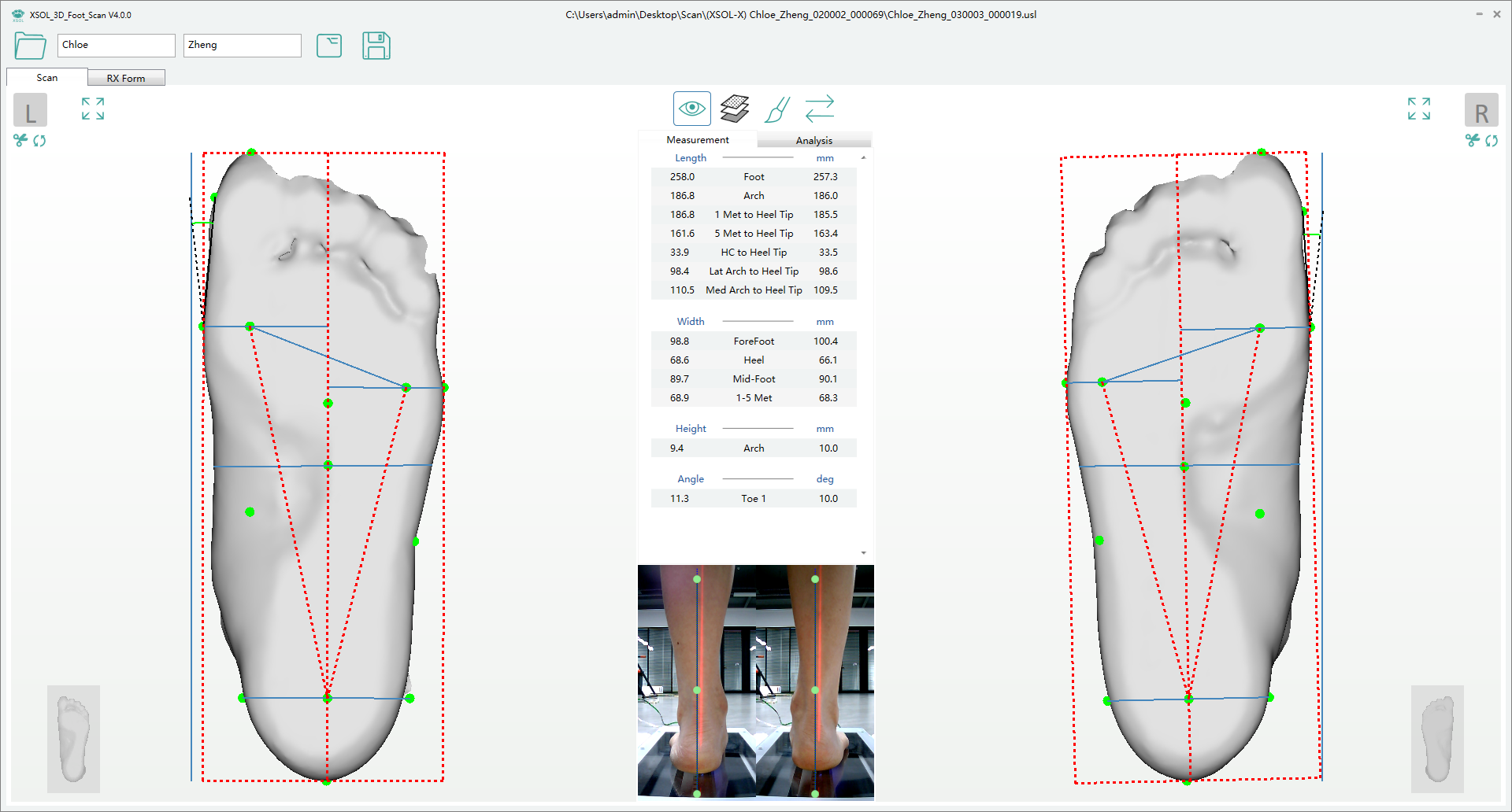 ScanPod3D 3D Laser Foot Scanner | Orthotic Insole CAD & CAM ...