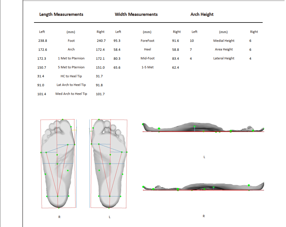 ScanPod3D 3D Laser Foot Scanner | Orthotic Insole CAD & CAM ...
