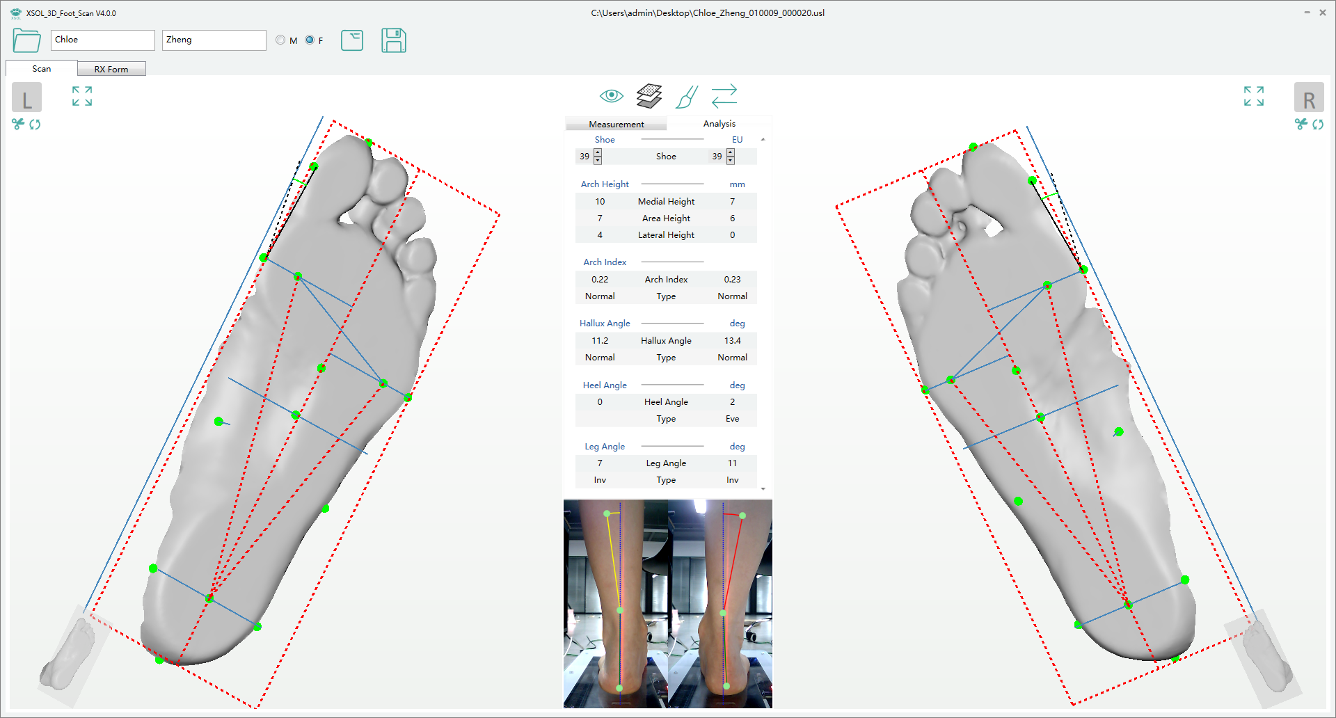ScanPod3D 3D Laser Foot Scanner | Orthotic Insole CAD & CAM ...