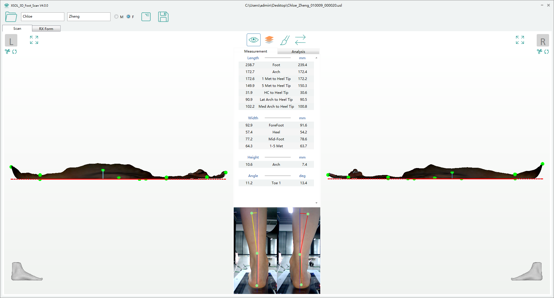 ScanPod3D 3D Laser Foot Scanner | Orthotic Insole CAD & CAM ...